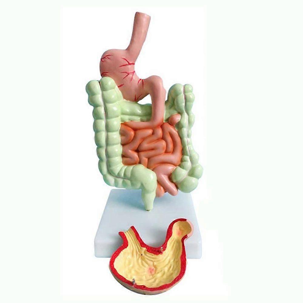 Human Digestive System Model Stomach Anatomy Large Intestine Cecum ...