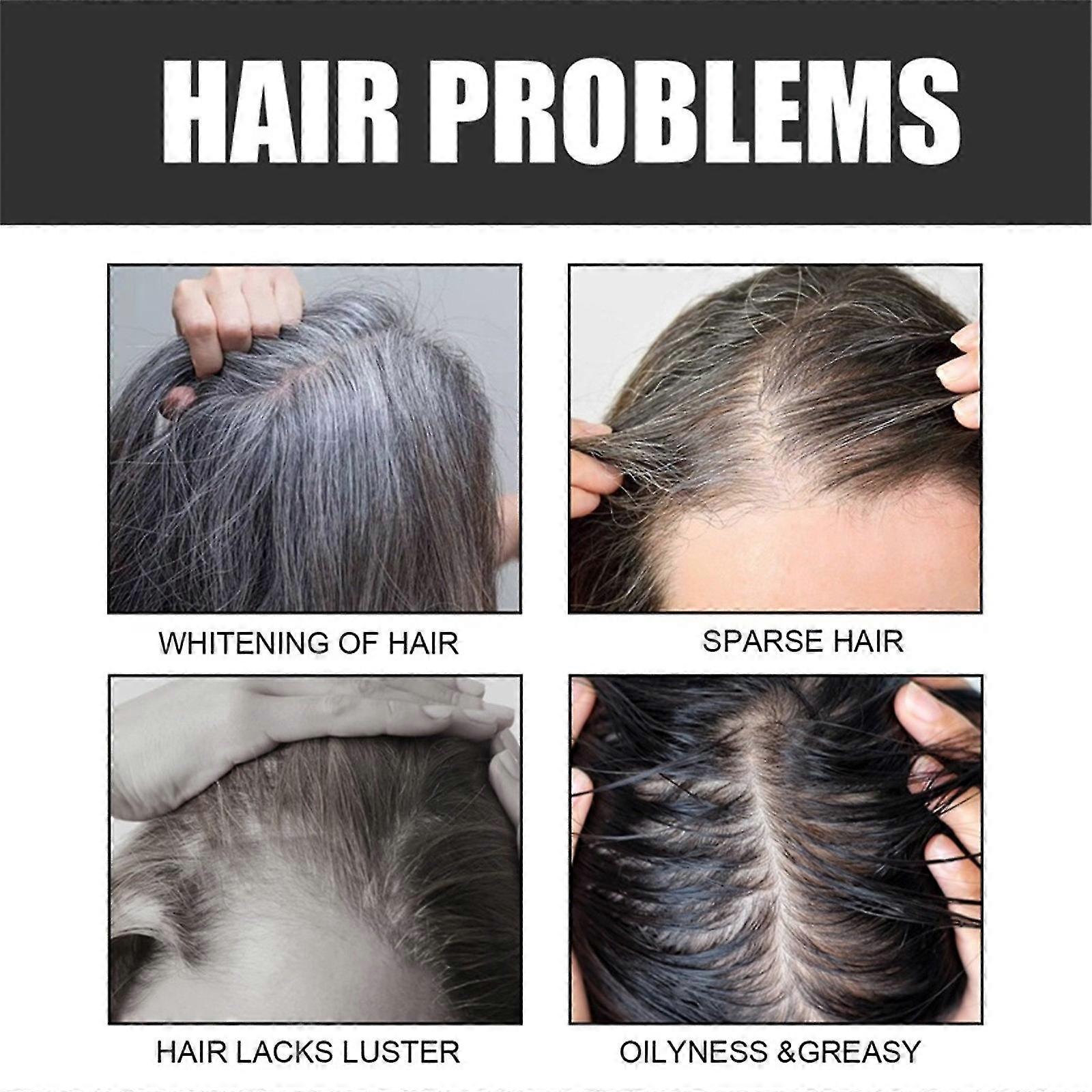 Gray Reverse Bar,cover Gray Hair Bar Soap,natural Hair Darkening ...