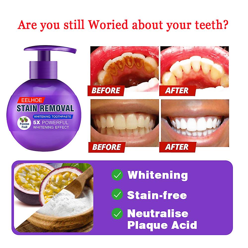 Stain Removal Whitening Toothpaste Fight Bleeding Gums Toothpaste 100ml ...