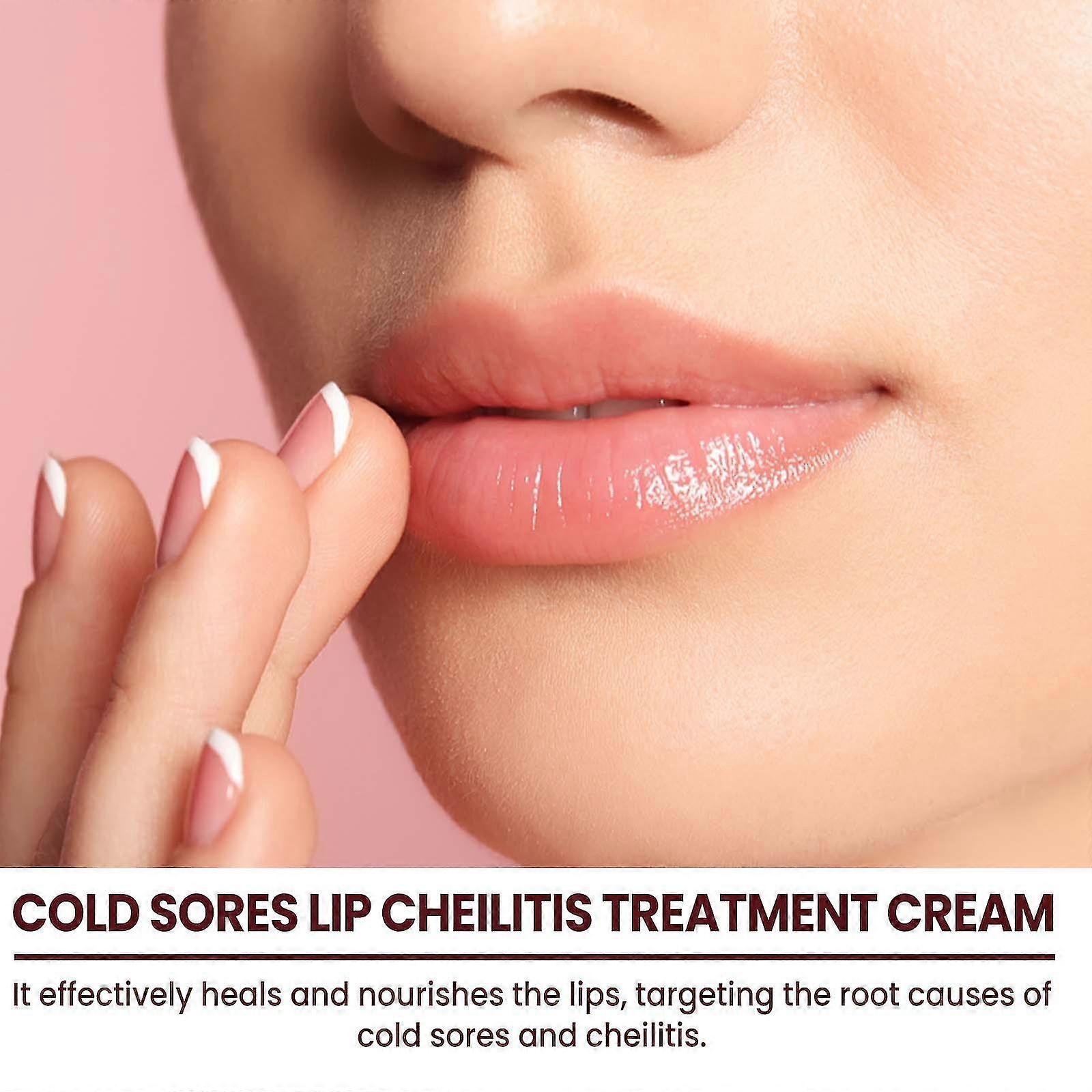 Lip Herpes And Cheilitis Cream, Effectively Nourishes Lips, And ...