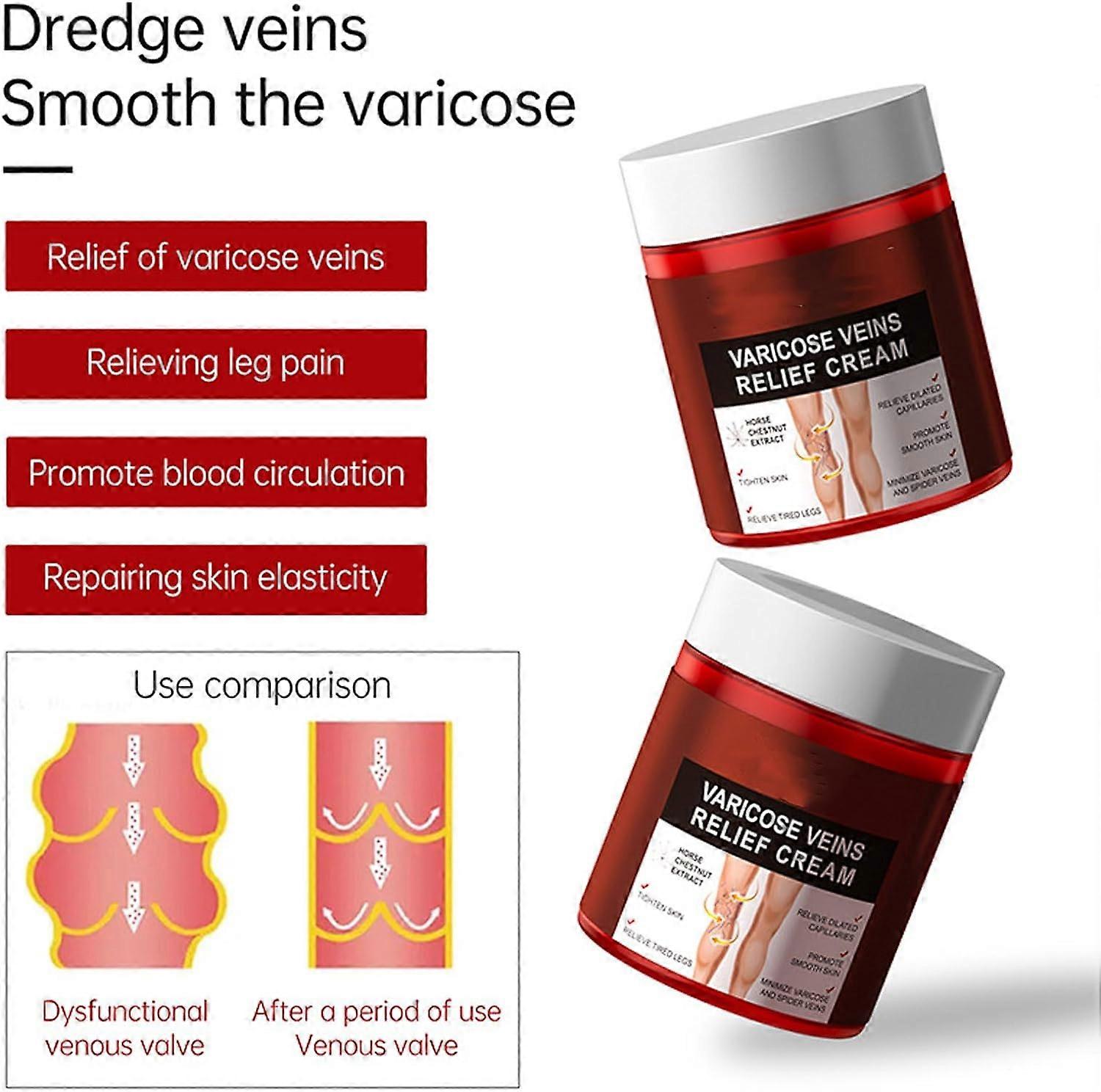 Varicose Relief Cream, Anti-Varicose Cream, Anti-Varicose Soothing ...