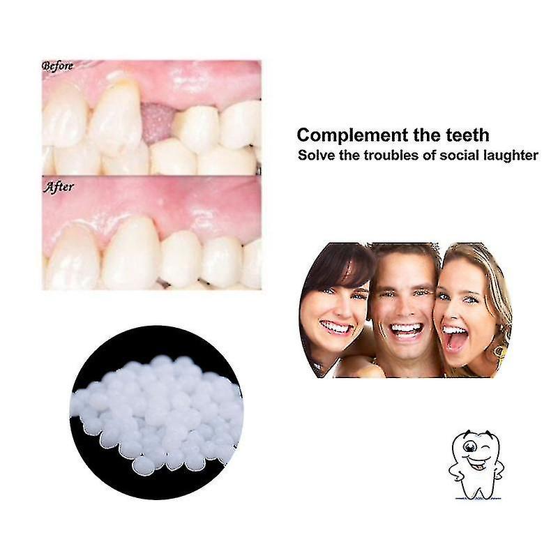 100g Temporary Tooth Filling Material Missing Teeth Repair Tool Oral ...