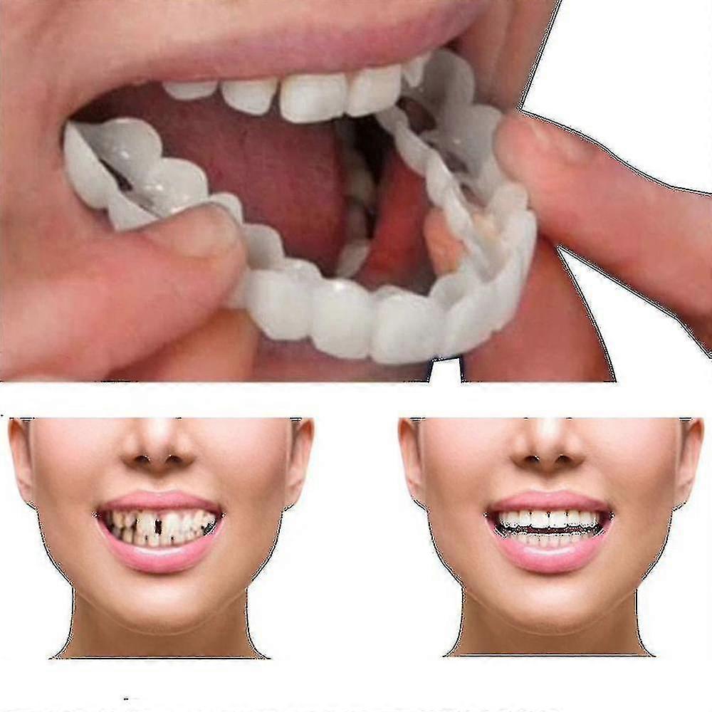 Prosthetic teeth covering upper teeth veneer covering teeth | Fruugo UK