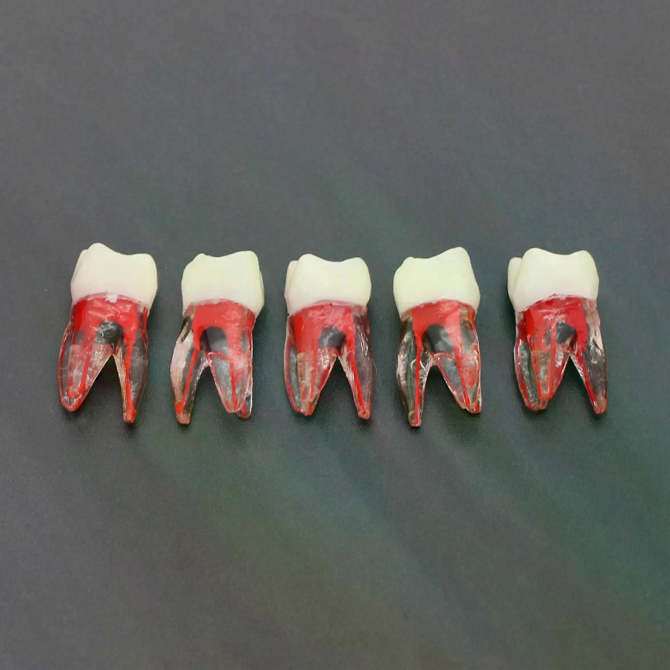 Gaibosi 5Pcs Dental Endodontic Root Model with Clear Resin Canal Block ...