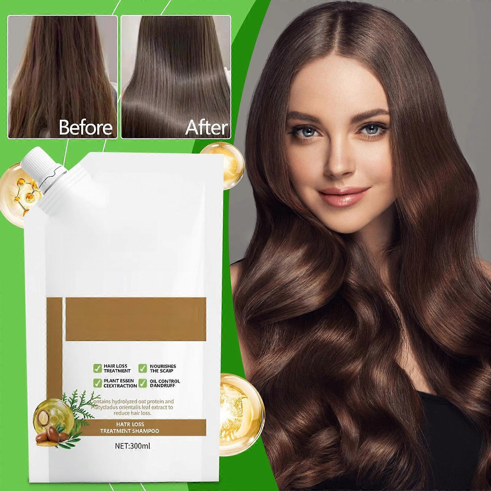 Hair Fall Hair Shampoo Oil Control Dandruff Hair Loss Rambut Rontok ...