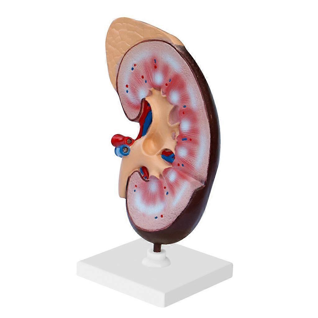 Human Body Kidney Anatomical Model, Educational Tool Teaching Aids ...