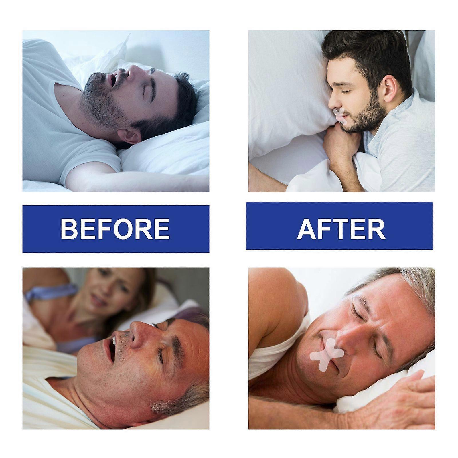 Anti-Snoring Tape Sleep Seal Anti-Snoring Open Mouth Breathing Closed ...