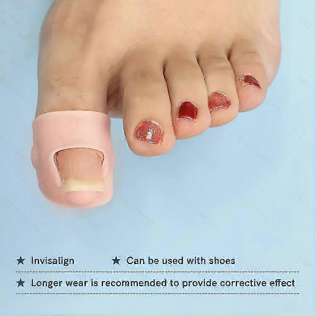 Anti-Wear Ingrown Toenail Protector Cover, Elastic Ingrown Toenail ...