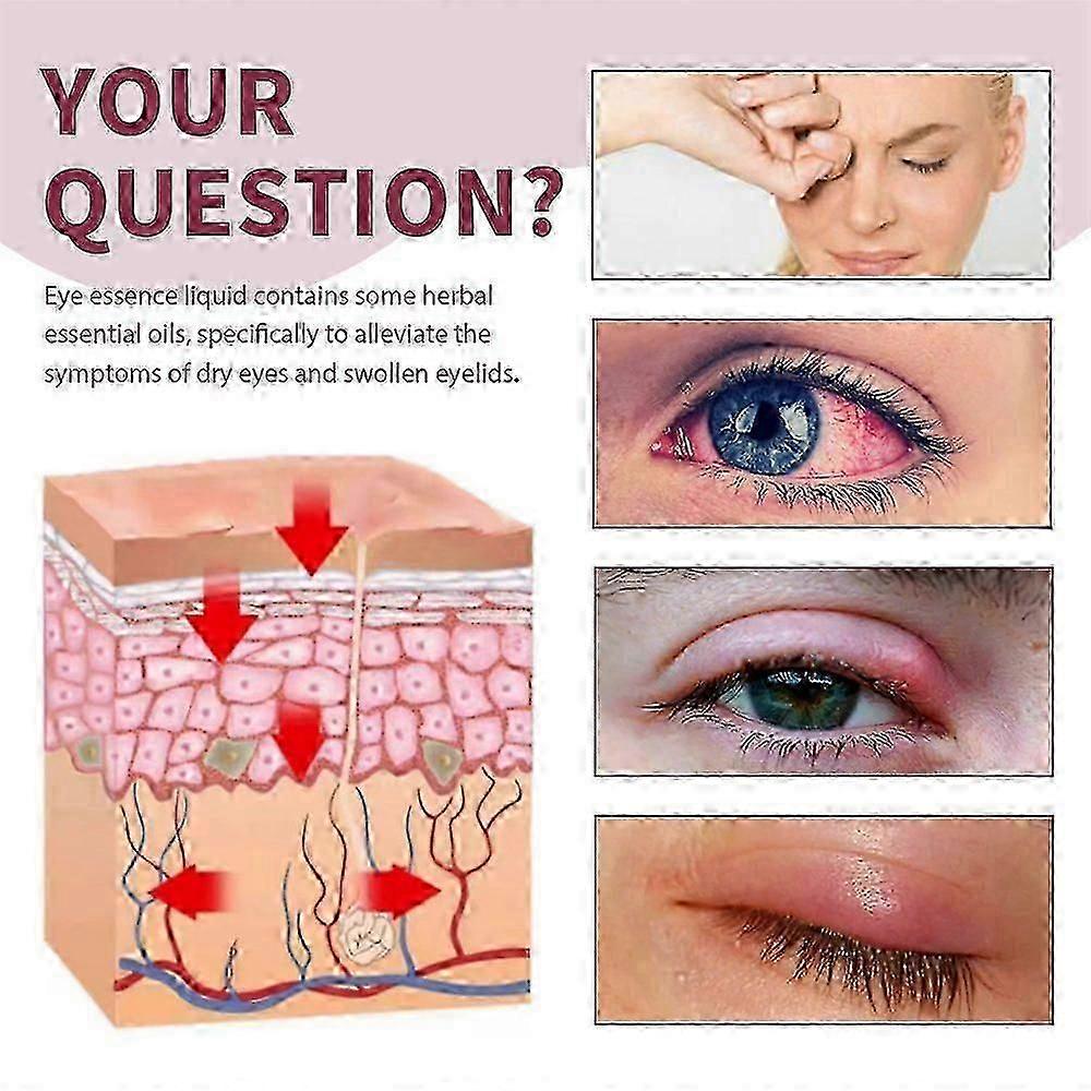 Eye Swelling Relief Essence Relieve Fatigue Eyesight Remove Fat Granule ...