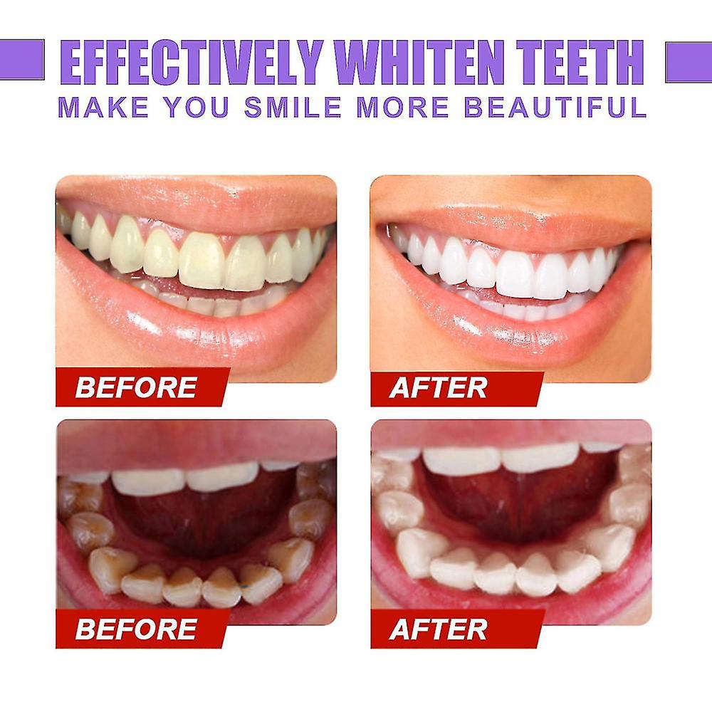 V34 Colour Corrector, Purple Teeth Whitening, Tooth Stain Removal ...