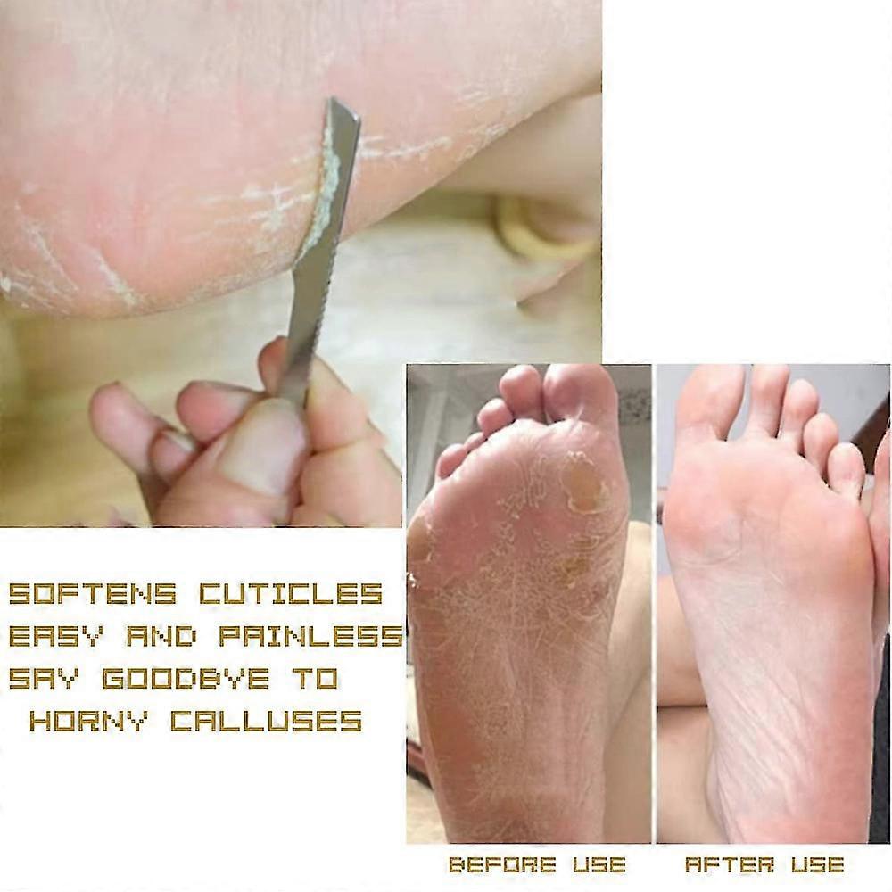 Pedicure Knife Set - Professional Foot File Dead Crust Remover Corn ...