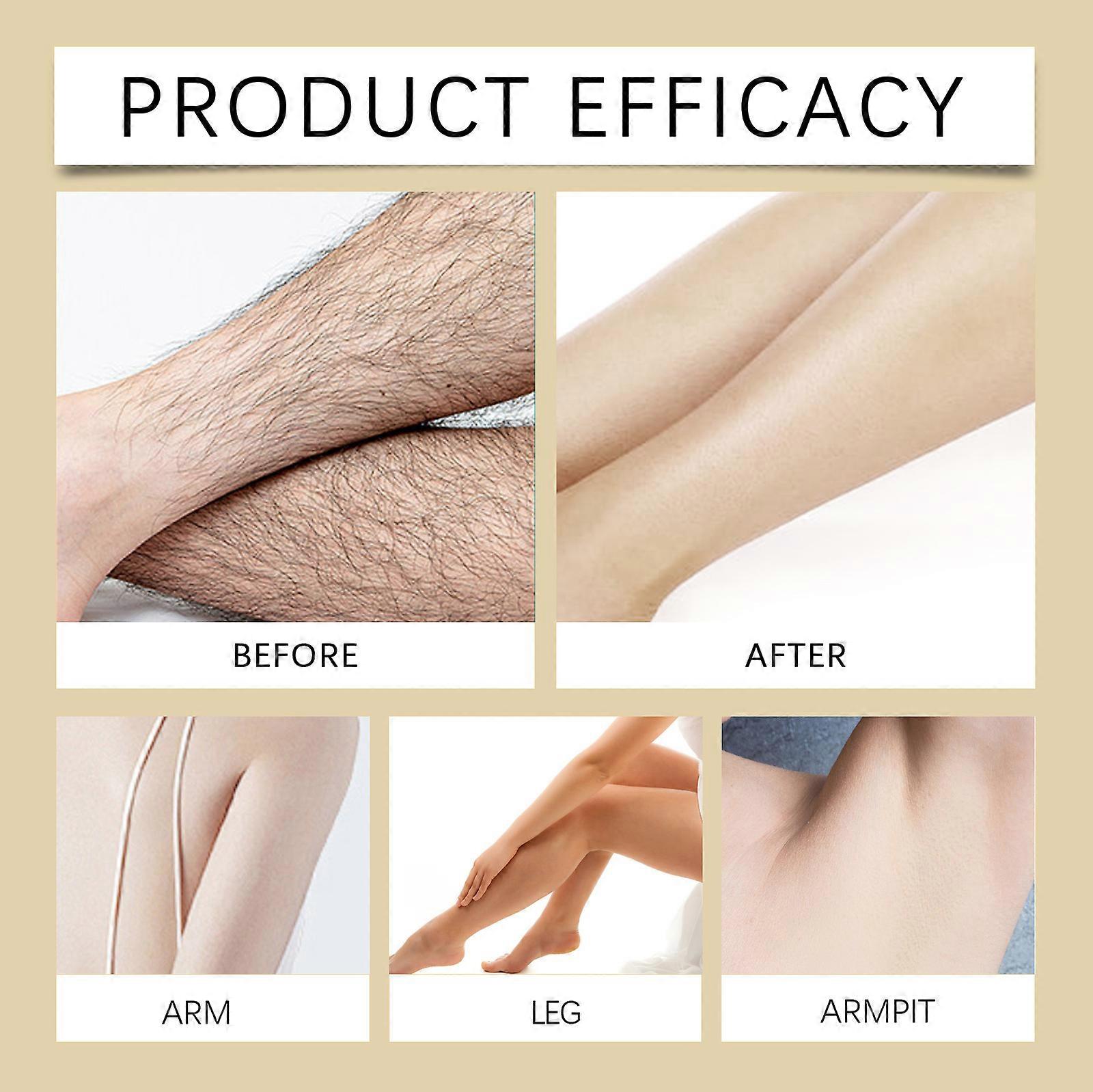 Cyperus Rotundus Oil for Reducing Body Hair Growth, Hair Removal ...