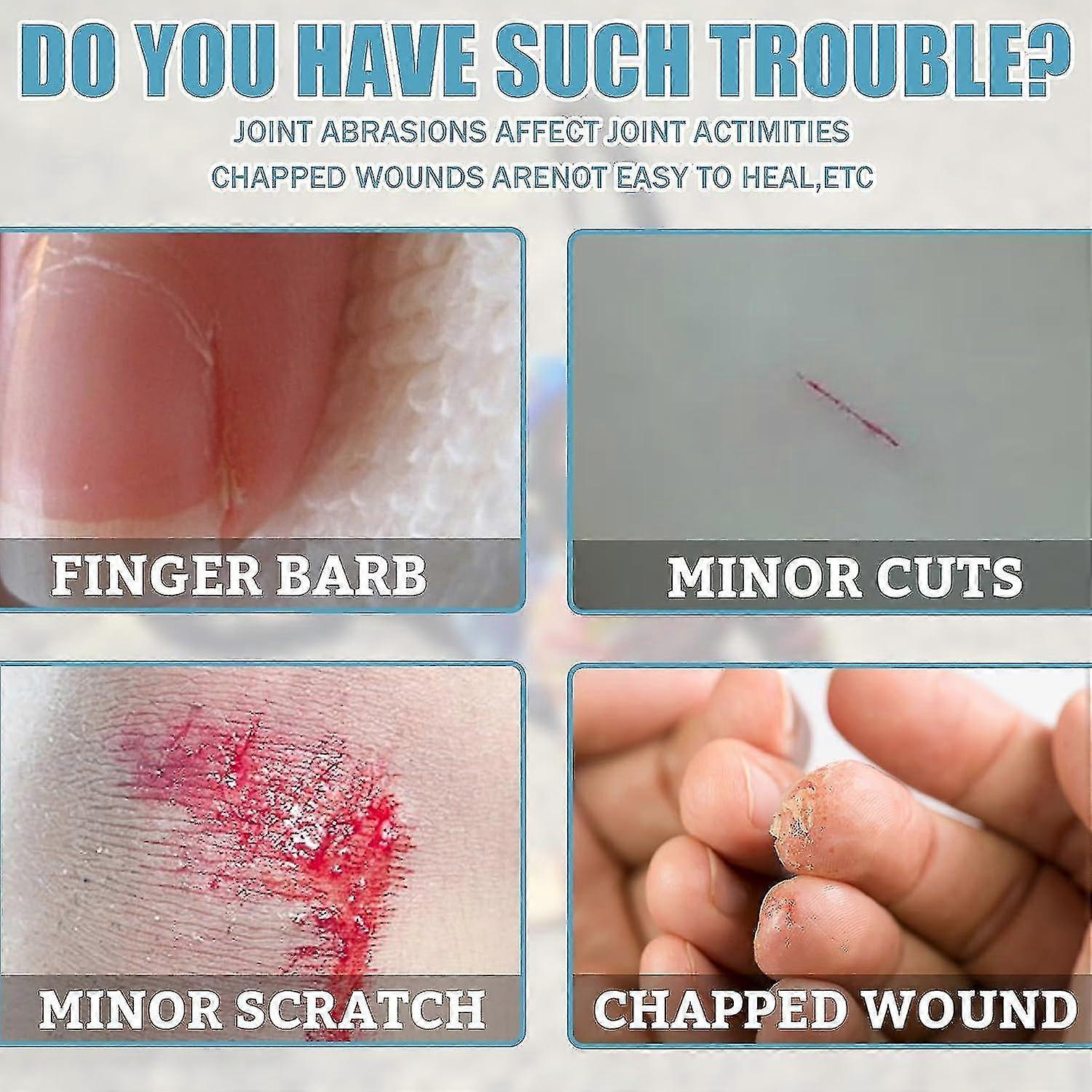 Liquid Bandages, Liquid Skin Glue For Wounds Human, Waterproof ...