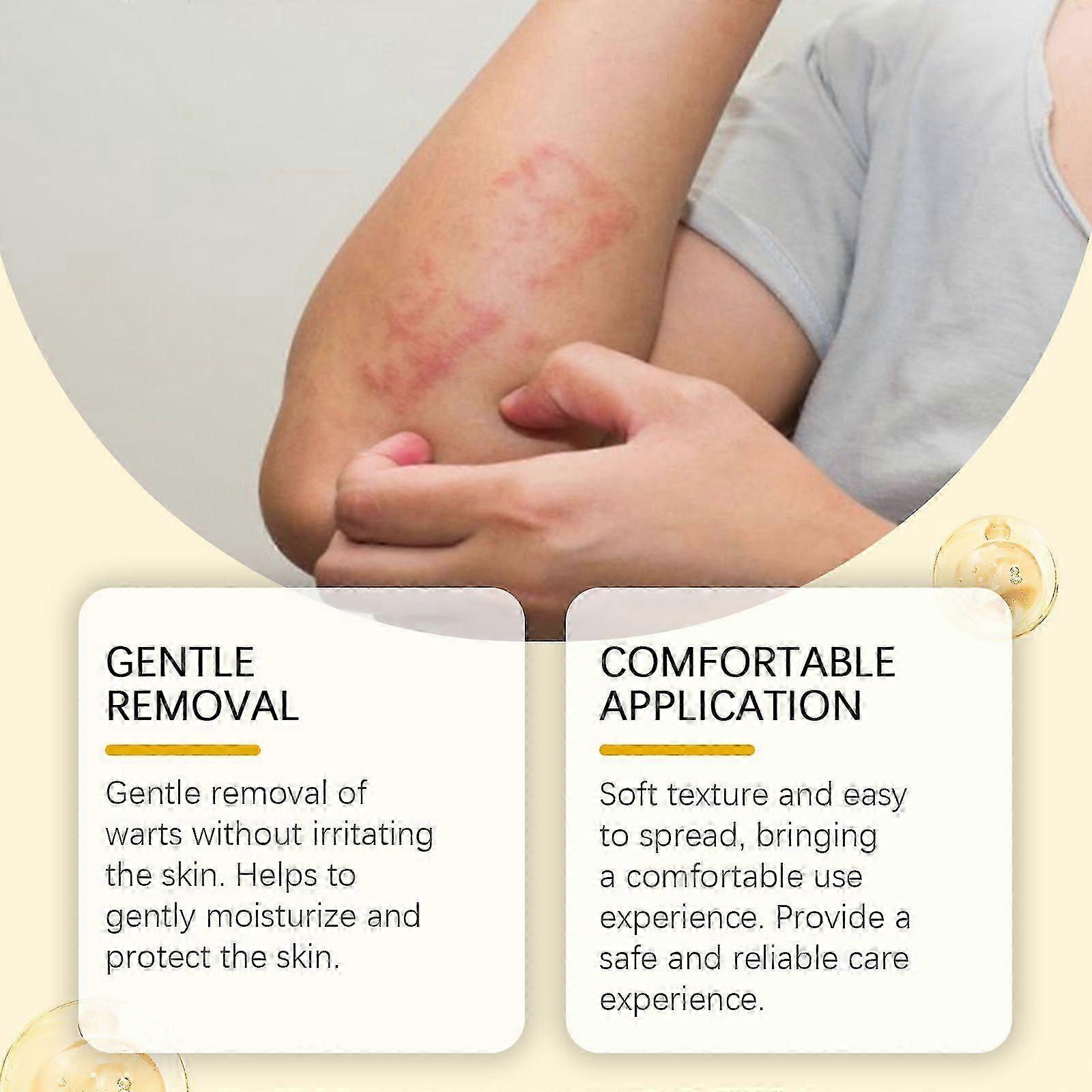 Bee Venom Repair Cream, Bee Venom Comprehensive Cream, Bee Venom Anti ...