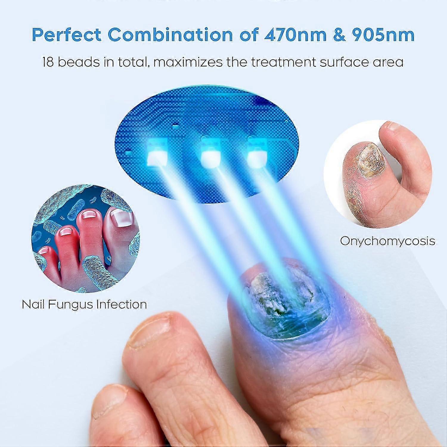 Nail Fungus Cleaning Laser Device for Multiple Toenail, 905nm Infrared ...