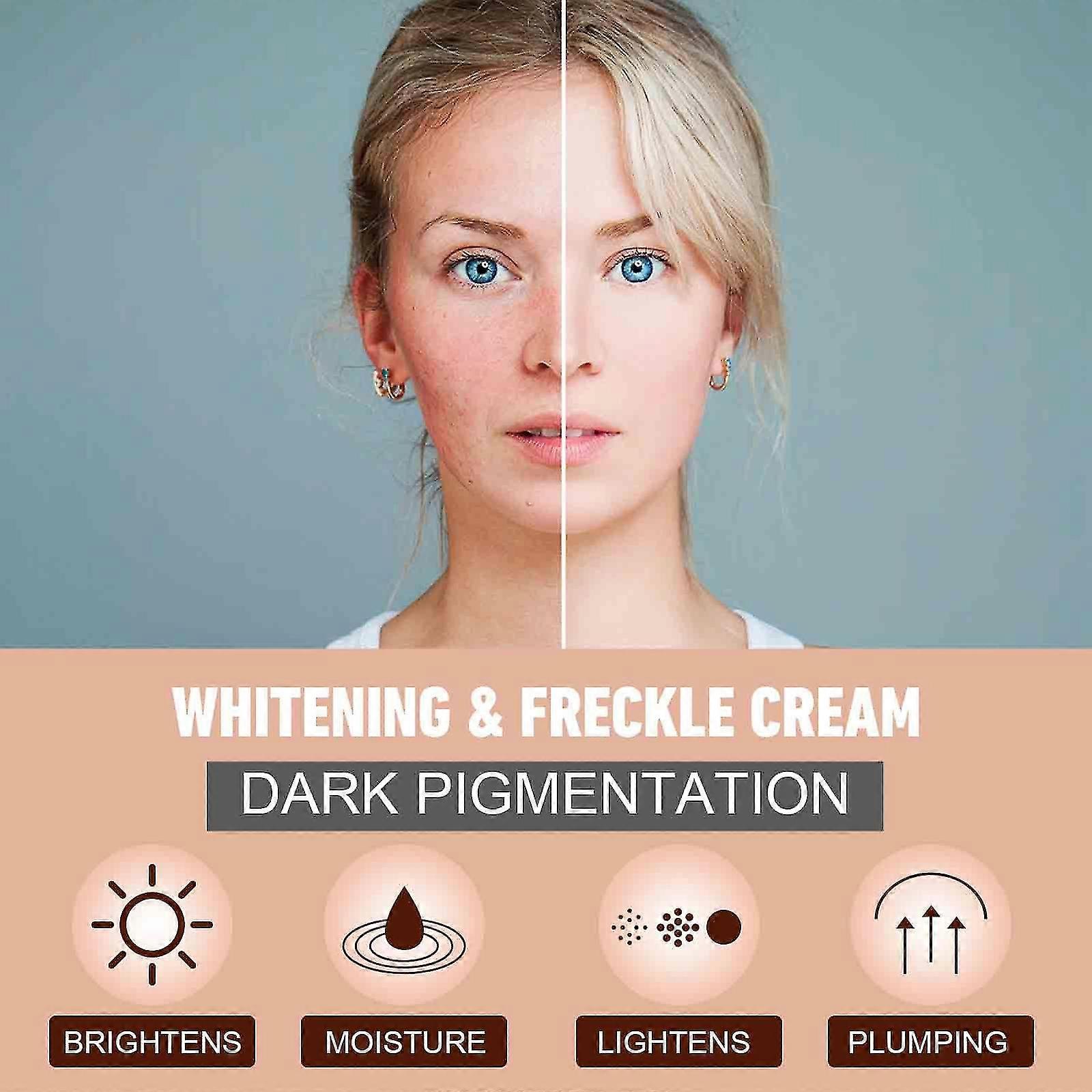 Whitening Cream For Armpit Elbow Knee Lightening Bikini Underarm Inner ...