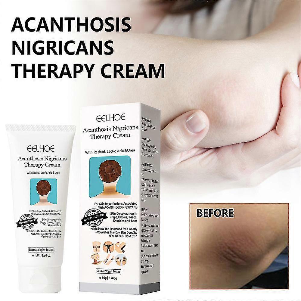 1/2/3pcs Acanthosis Cream Nigrifix Cream For Acanthosis Nigricans Black ...