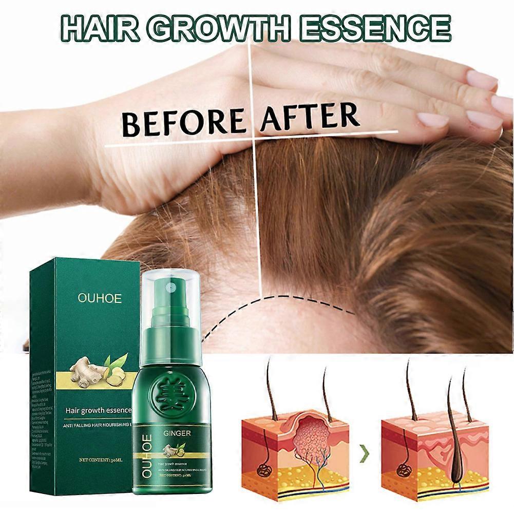 1-3pcs Hair Ginger Growth Products Ginger Fast Grow Oil Anti Hair Loss ...