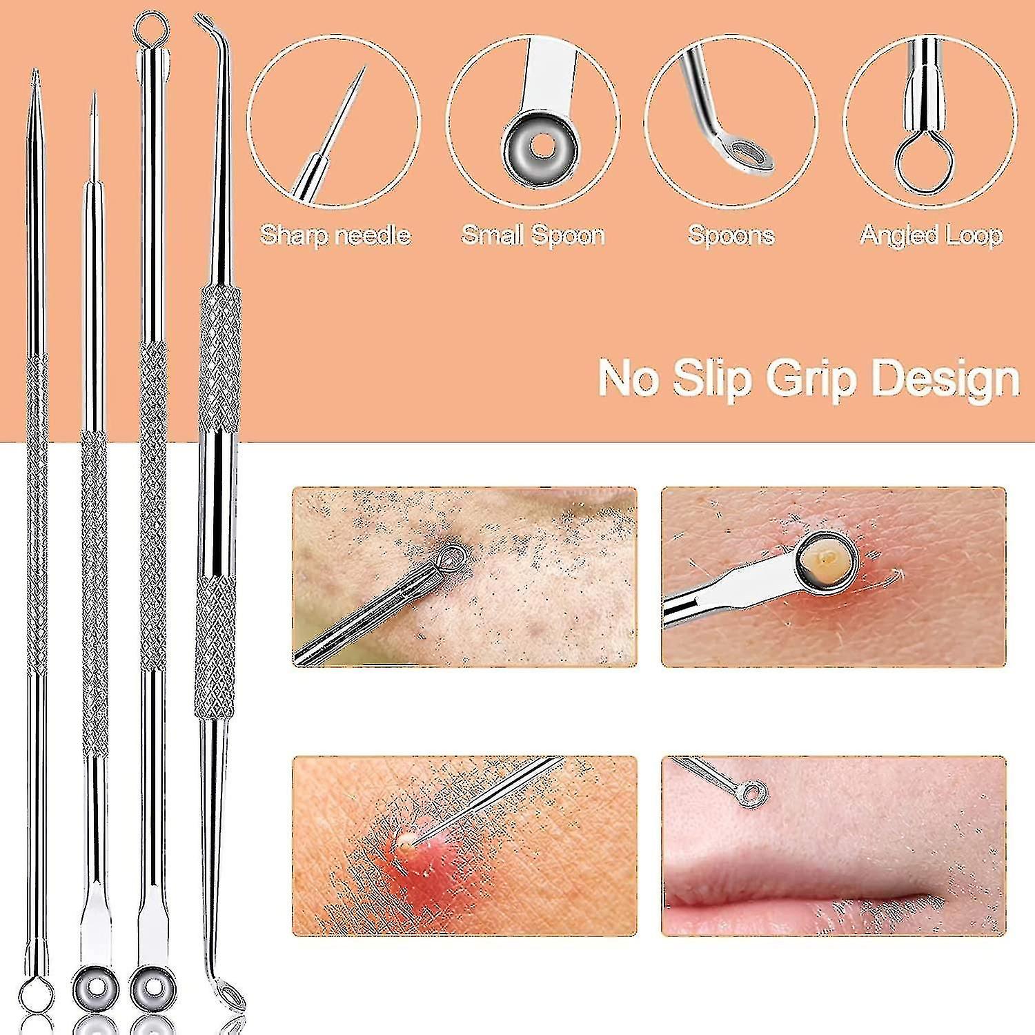 Blackhead Remover Pimple Tool Kit 10 Pcs, Comedone Pimple(silver ...