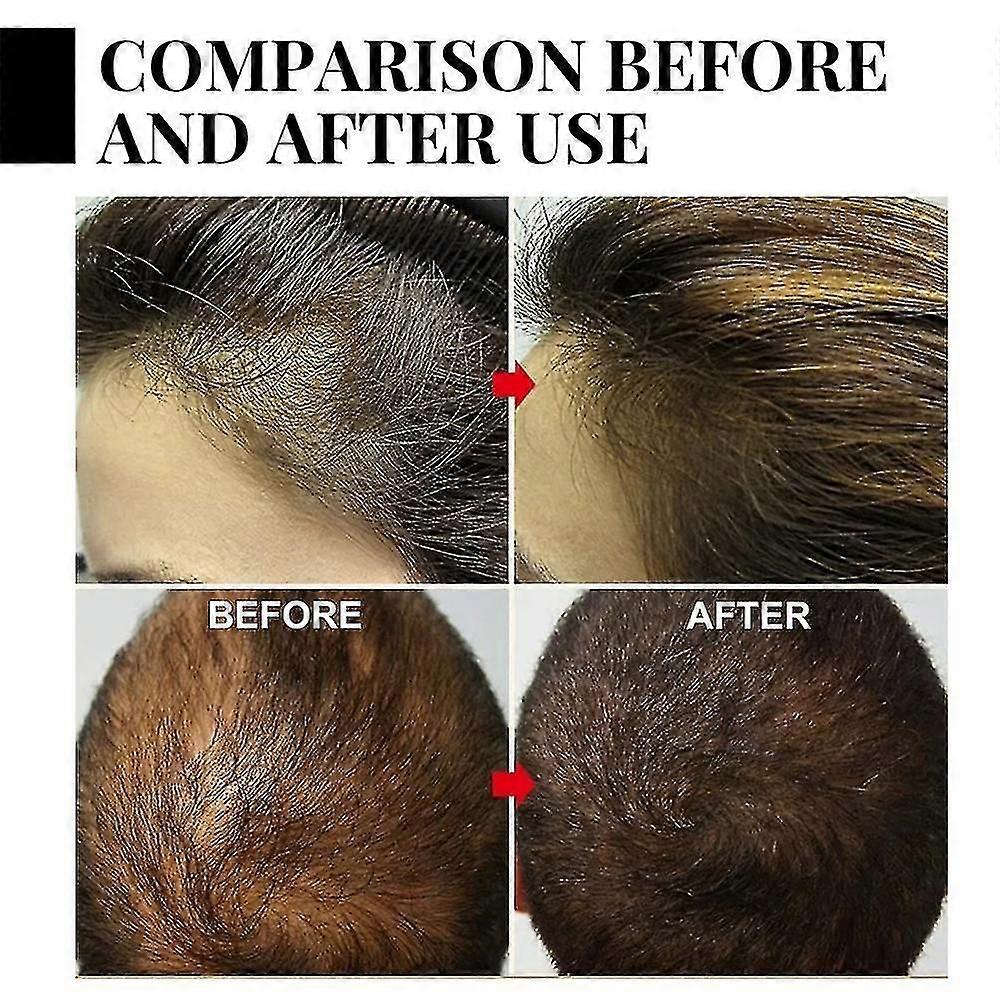 3PCS Natural 100% Pure Batana Oil For Hair Growth Batana Oil Butter ...