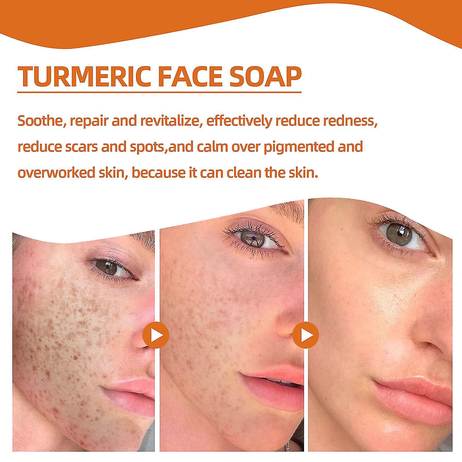 Turmeric Cleansing Soap Natural Anti-aging Exfoliating Cleansing Soap ...