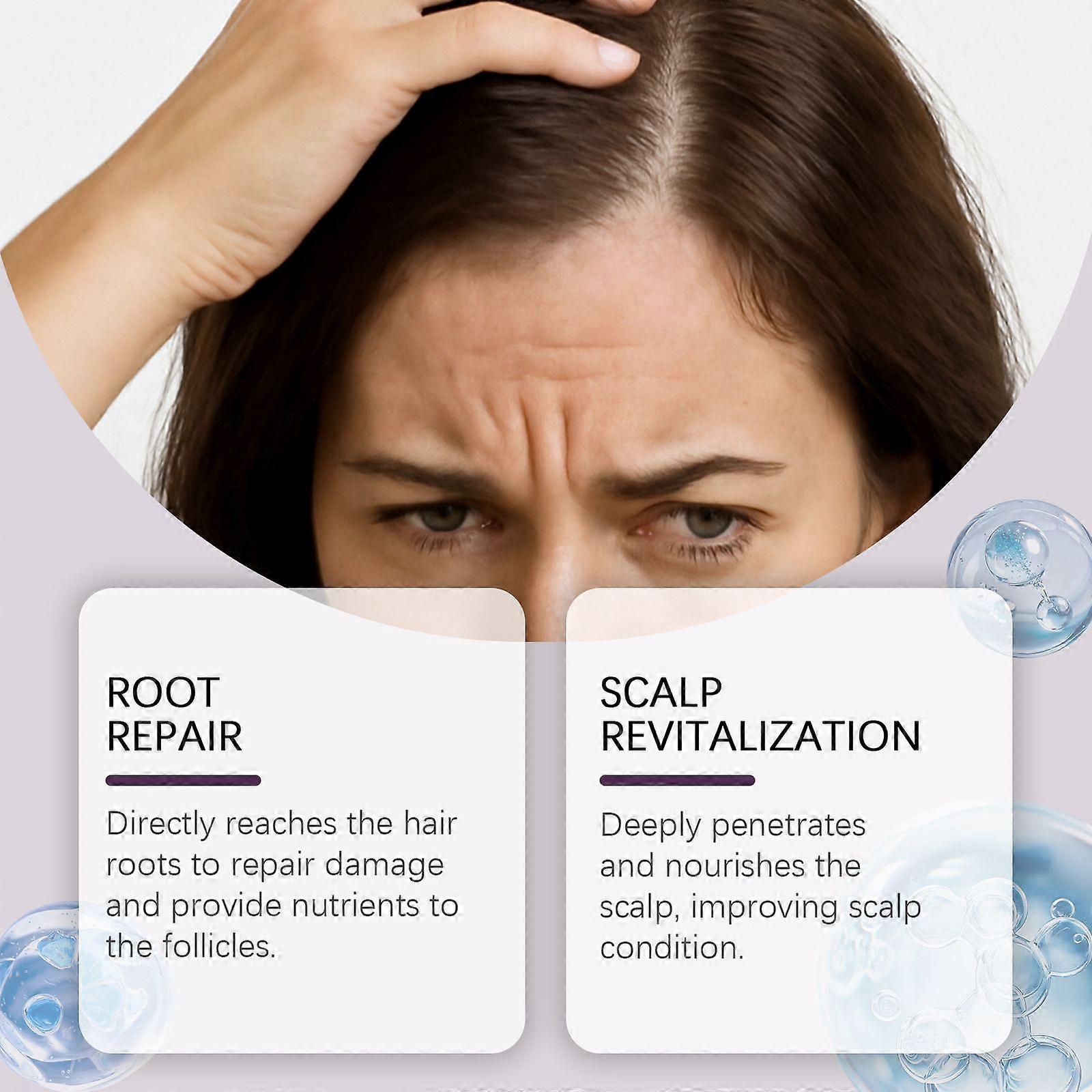 1~5PCS DR.Groot Hair Thickening Serum for Hair Loss,Rosemary Hair ...