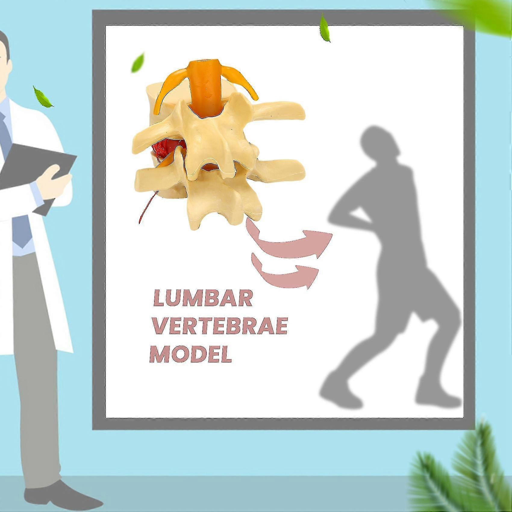 Lumbar Vertebrae Model Anatomical Lumbar Disc Herniation Anatomy ...
