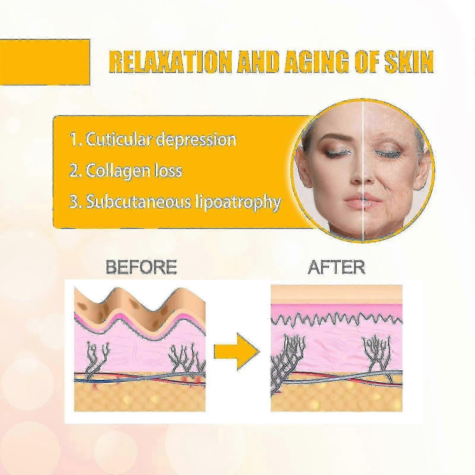 Jaysuing Collagen Smile Pattern Patch Lifting Facial Smile Pattern ...