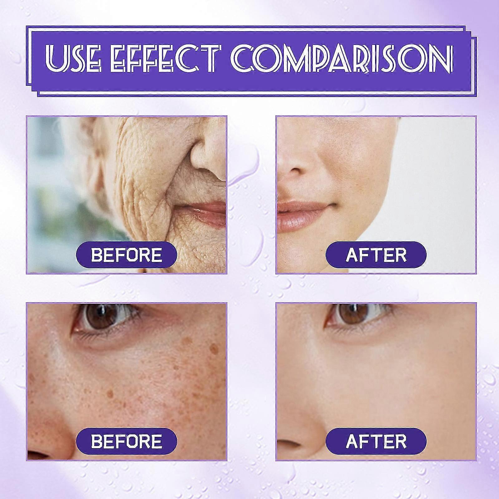 B3 Serum, Dark Spot Corrector B3 Serum With Anti-Aging 10% Niacinamide ...