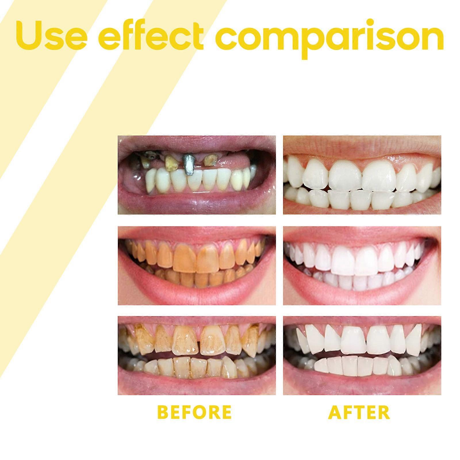 Propolis Gum Care Gel, Propolis Oral Gum Repair Gel, Propolis Teeth ...