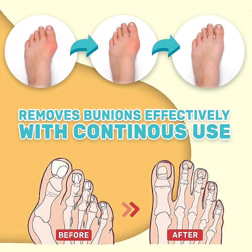 Bunion Toe Stiffness Relief Cream | Fruugo UK