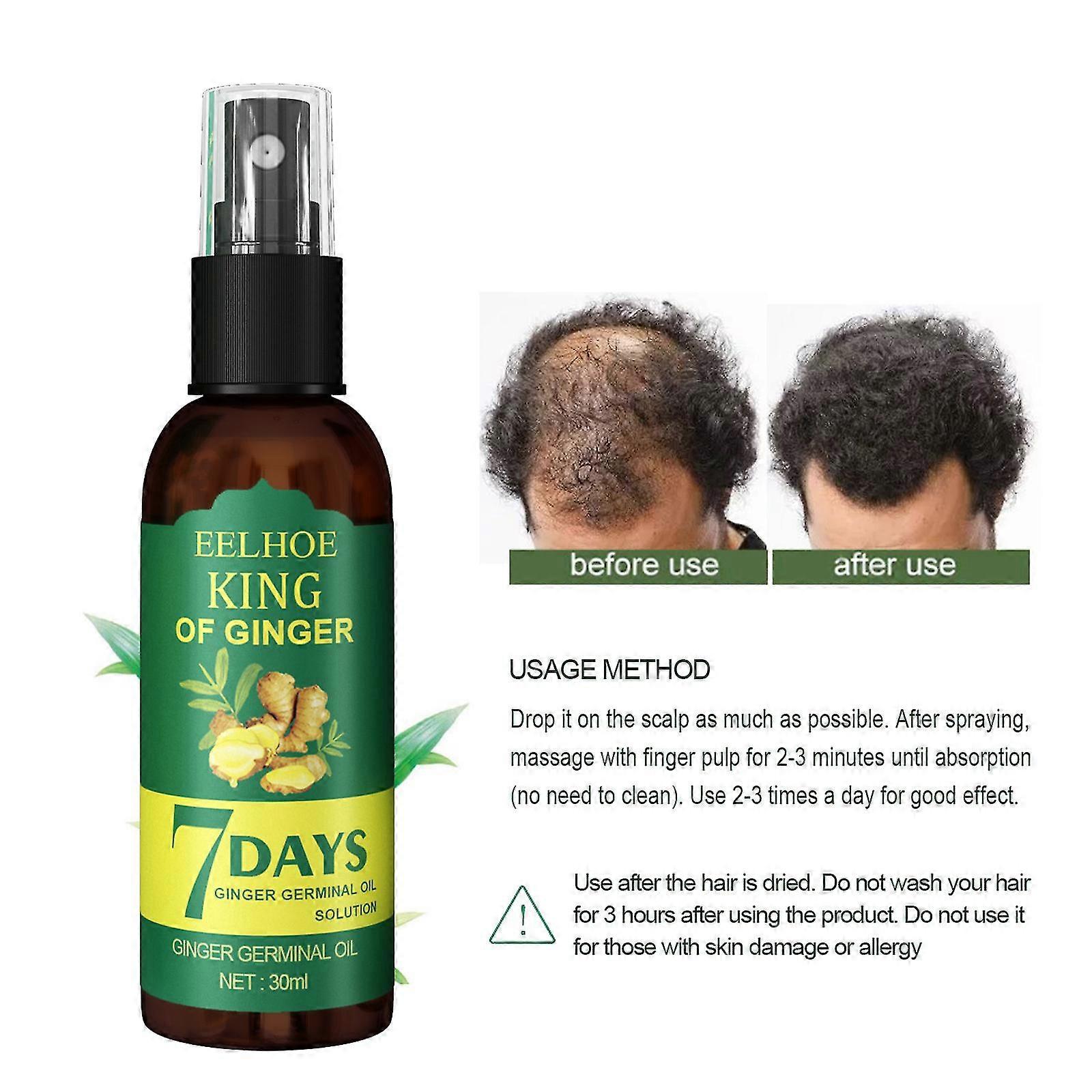 Ginger Hair Growth Serum Spray, Ginger Herb Formula Stop Hair Loss Hair ...