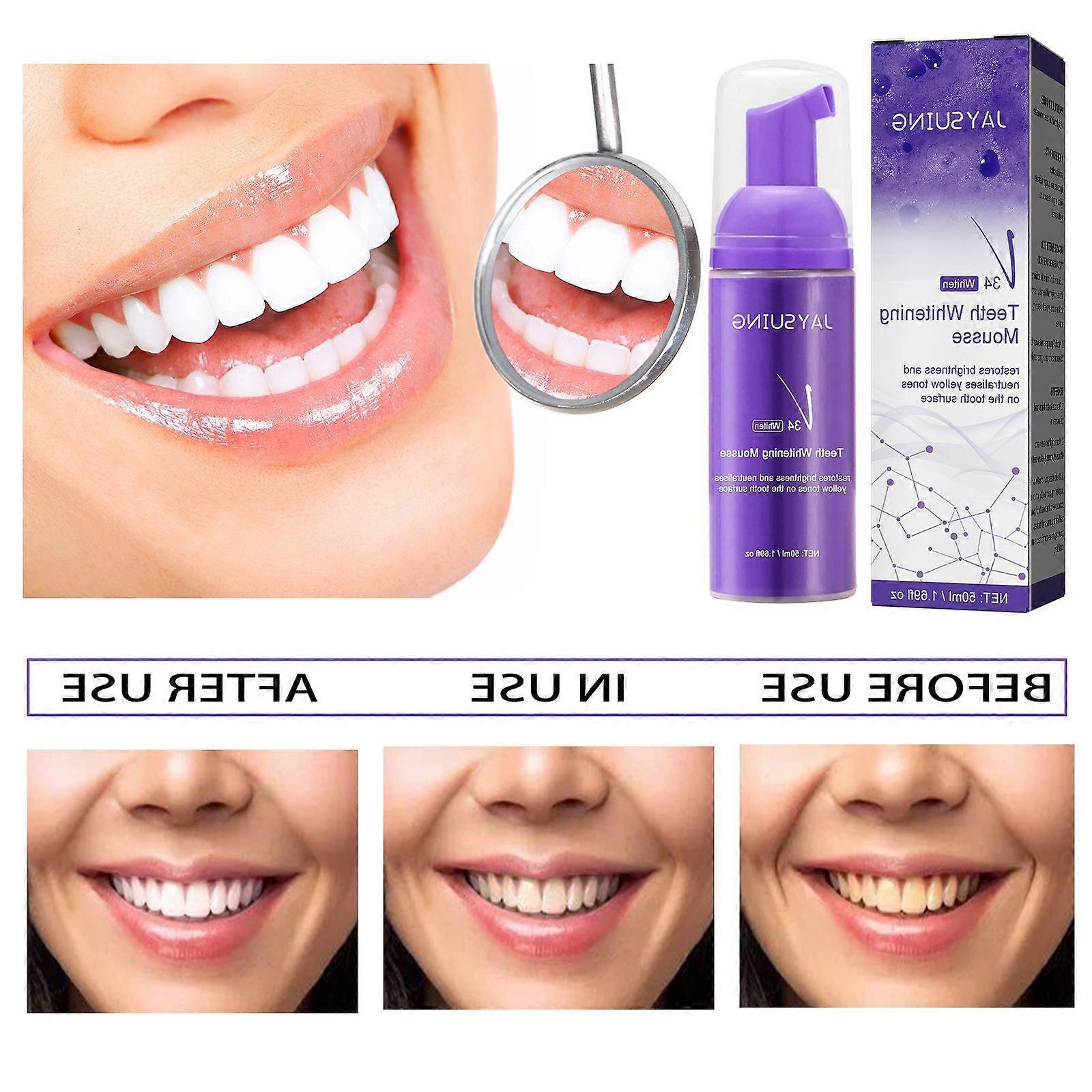 Jaysuing V34 Bright White Teeth Toothpaste Whitening Teeth Correction ...