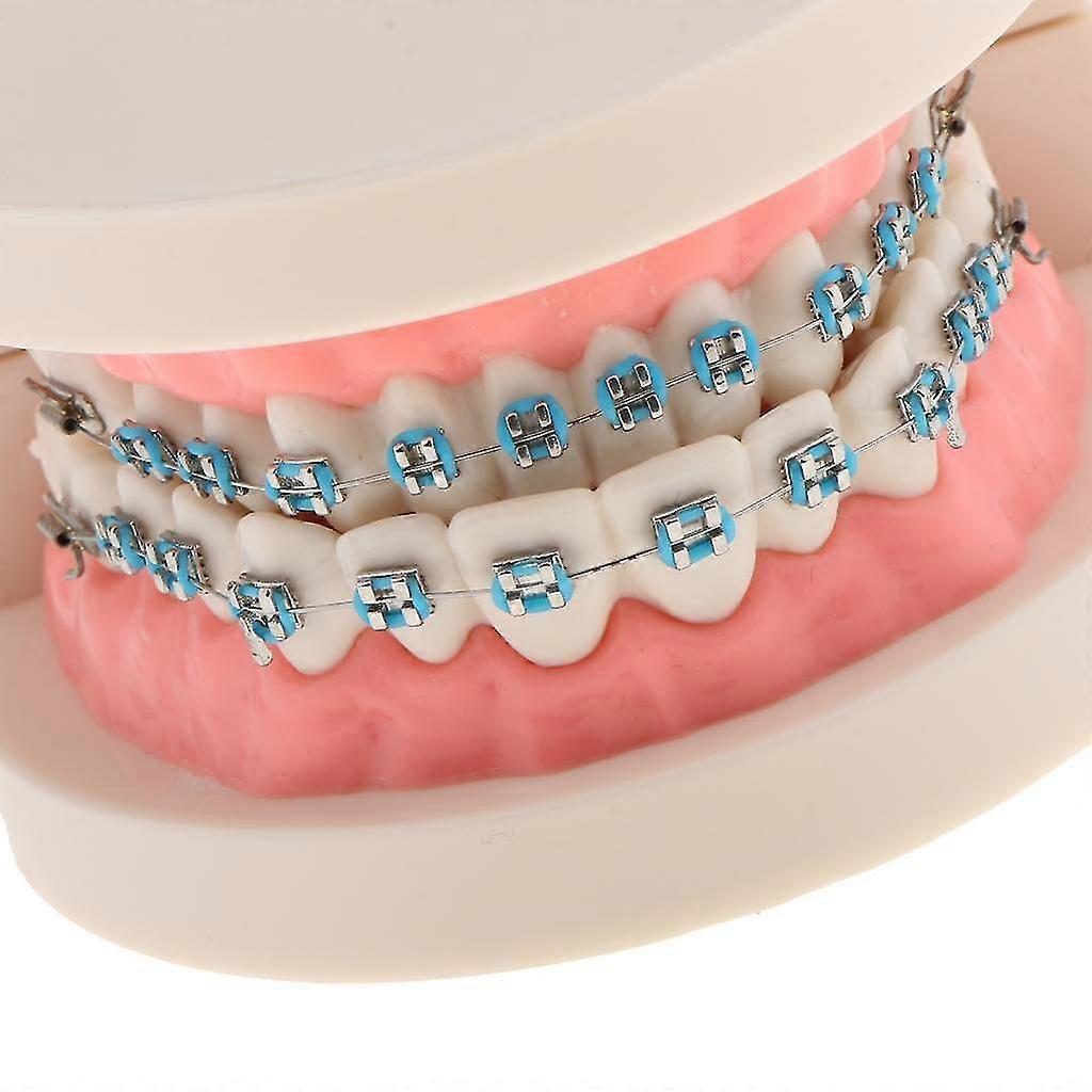 Dental Teach Study Orthodontic Tooth Teeth Model With Metal Brackets ...