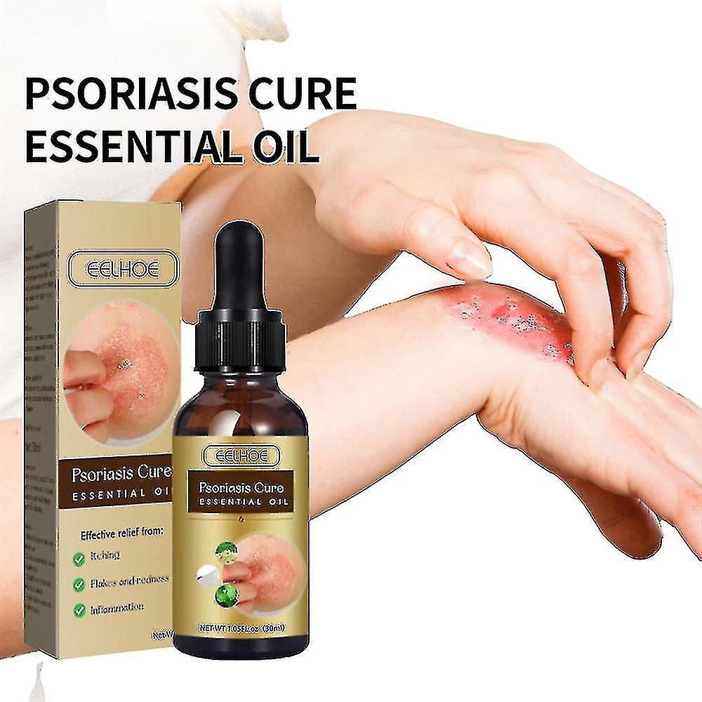 Psoriasis Oil Dermatitis Eczematoid Eczema Skin Oil | Fruugo UK
