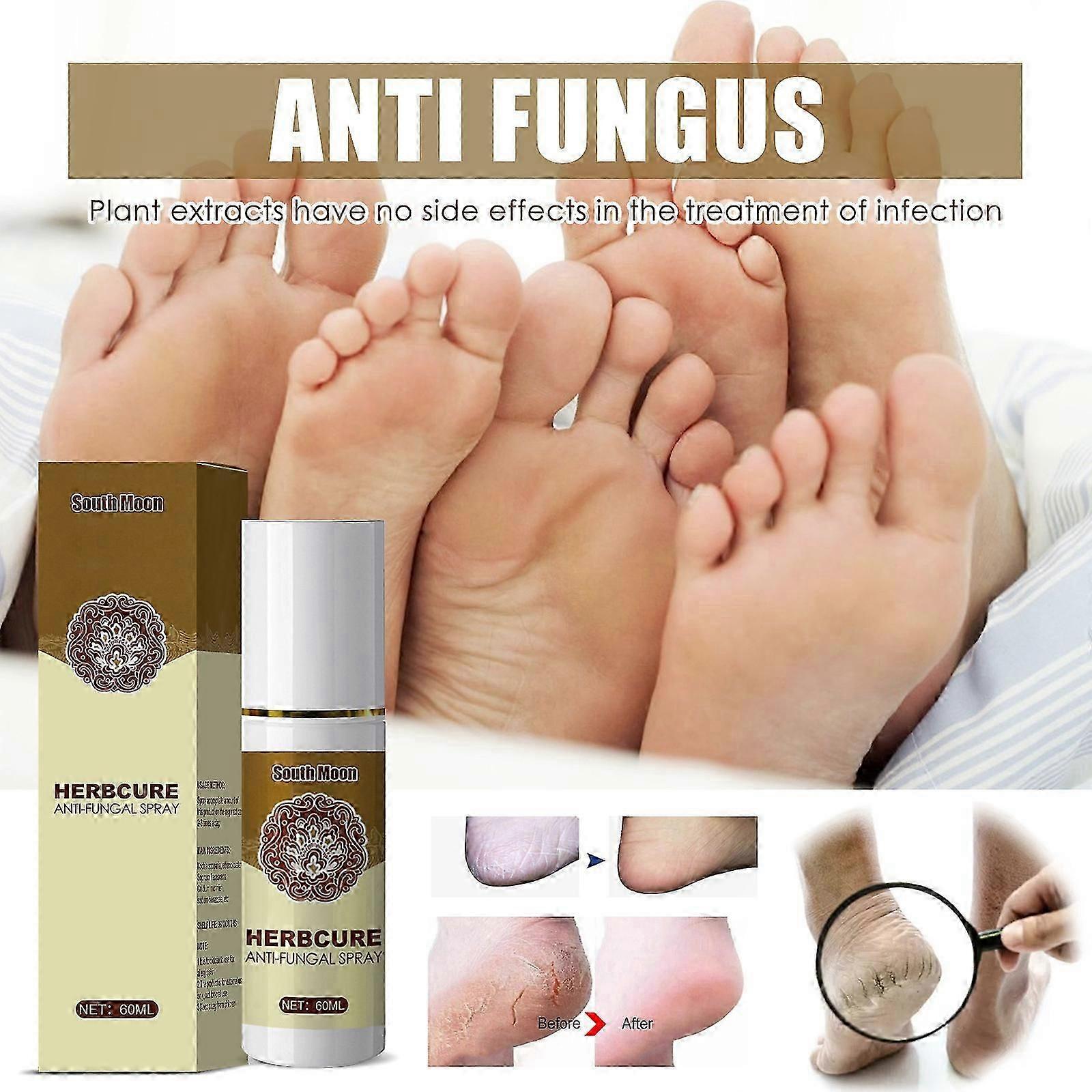 3pcs Anti Fungal Herbal Foot Spray Anti-itching Athlete's Foot Spray ...