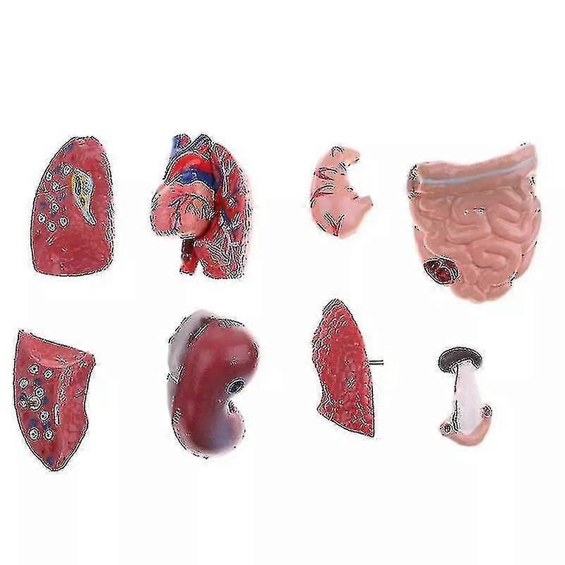 Detachable Human Torso Anatomy Model - Life-Size Medical Teaching Tool ...