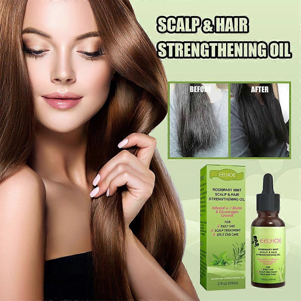 1-3pcs Romarin Menthe Hair Nutrition Liquid Hair Growth Scalp ...