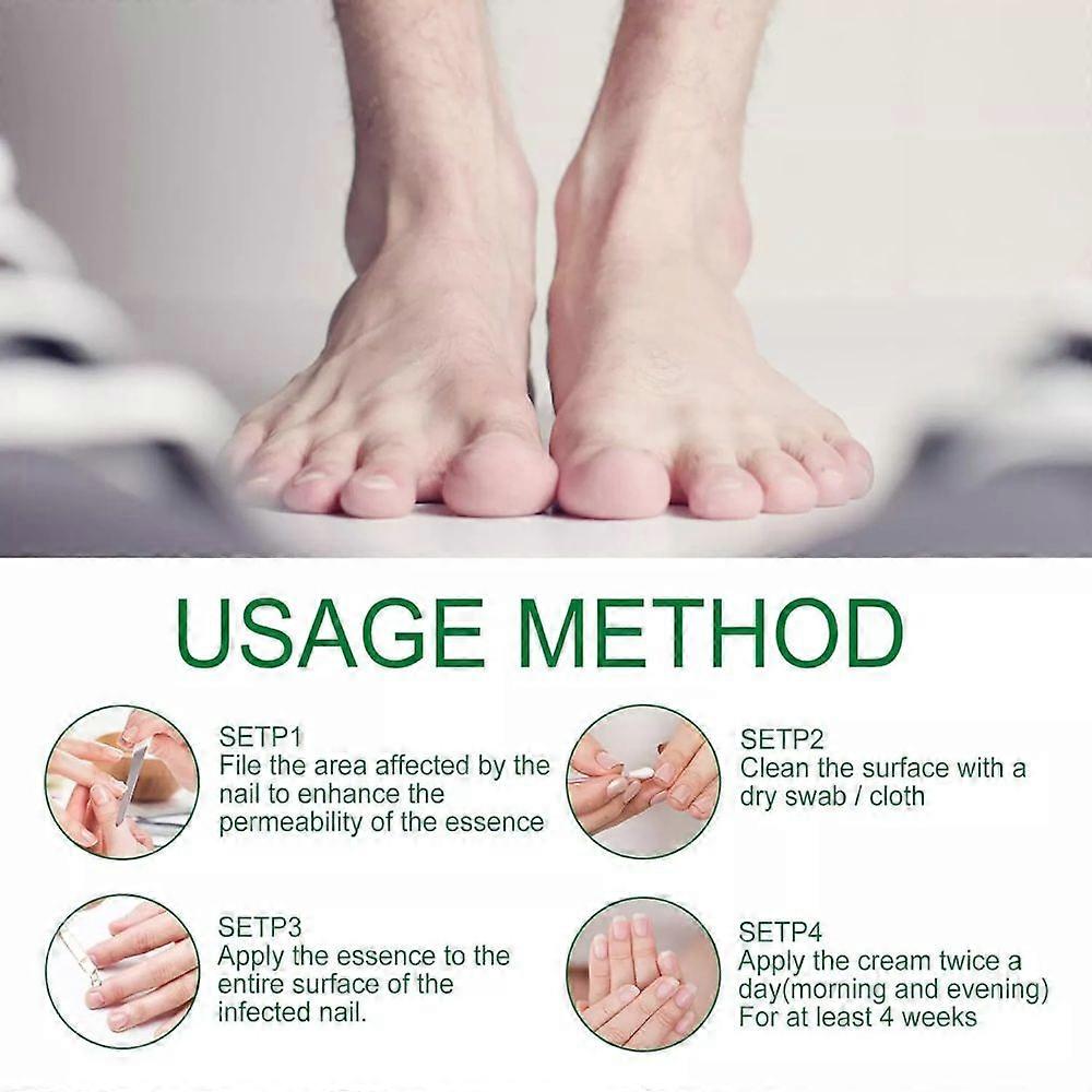 Ginger Nail Treatment Nail Care, Nail Growth Oil for Cuticle ...