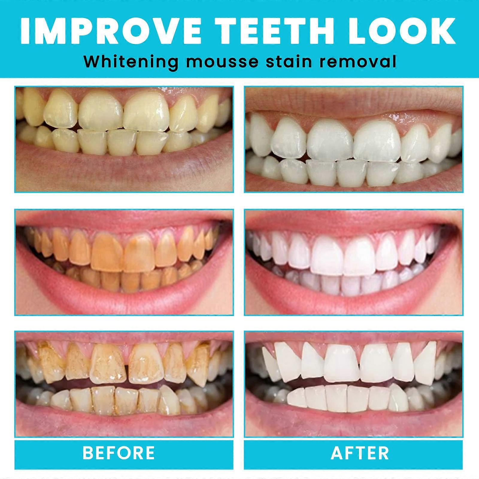 3pcs Teethaid Mouthwash, Teeth Aid Mouthwash, Teethaid Mouth Wash ...