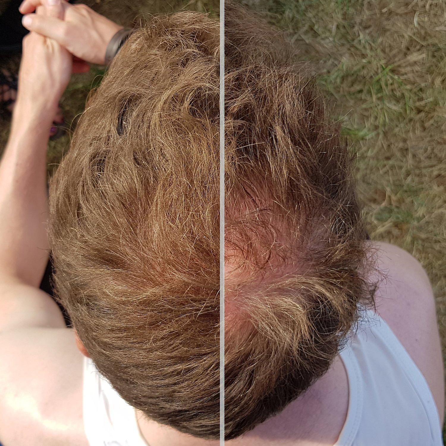 KERANEA Vegan Bulk Hair, Scattered Hair Compaction 27.5g | Fruugo UK