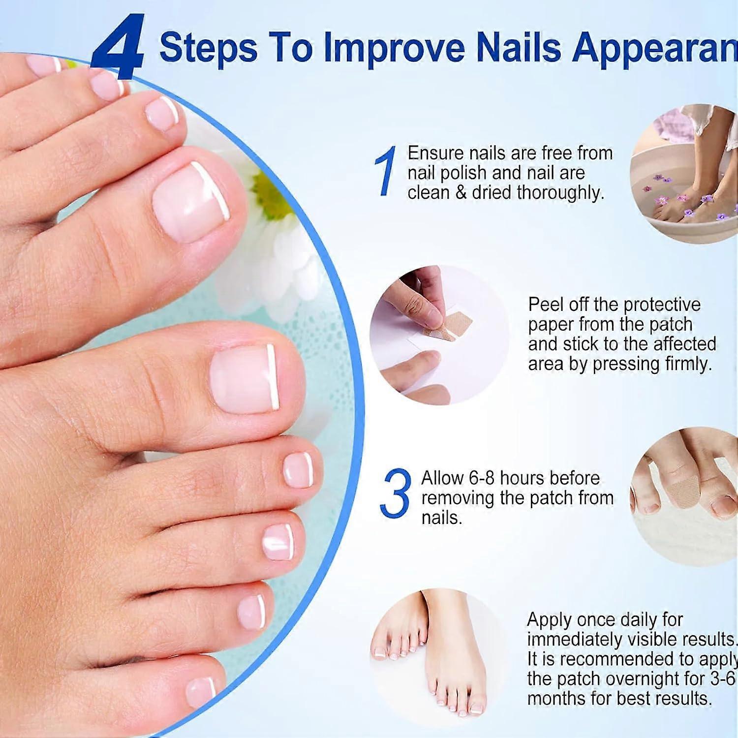 Fungal Nail Treatment, Nail Fungus Treatment Patch for Toenail, Toe ...