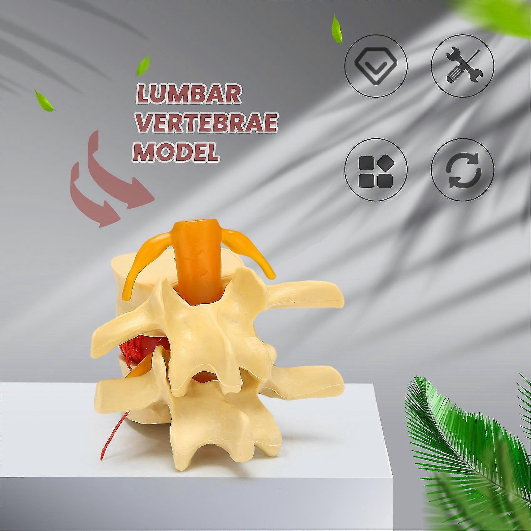 Model bederních obratlů Anatomická páteř Bederní ploténka Herniace ...