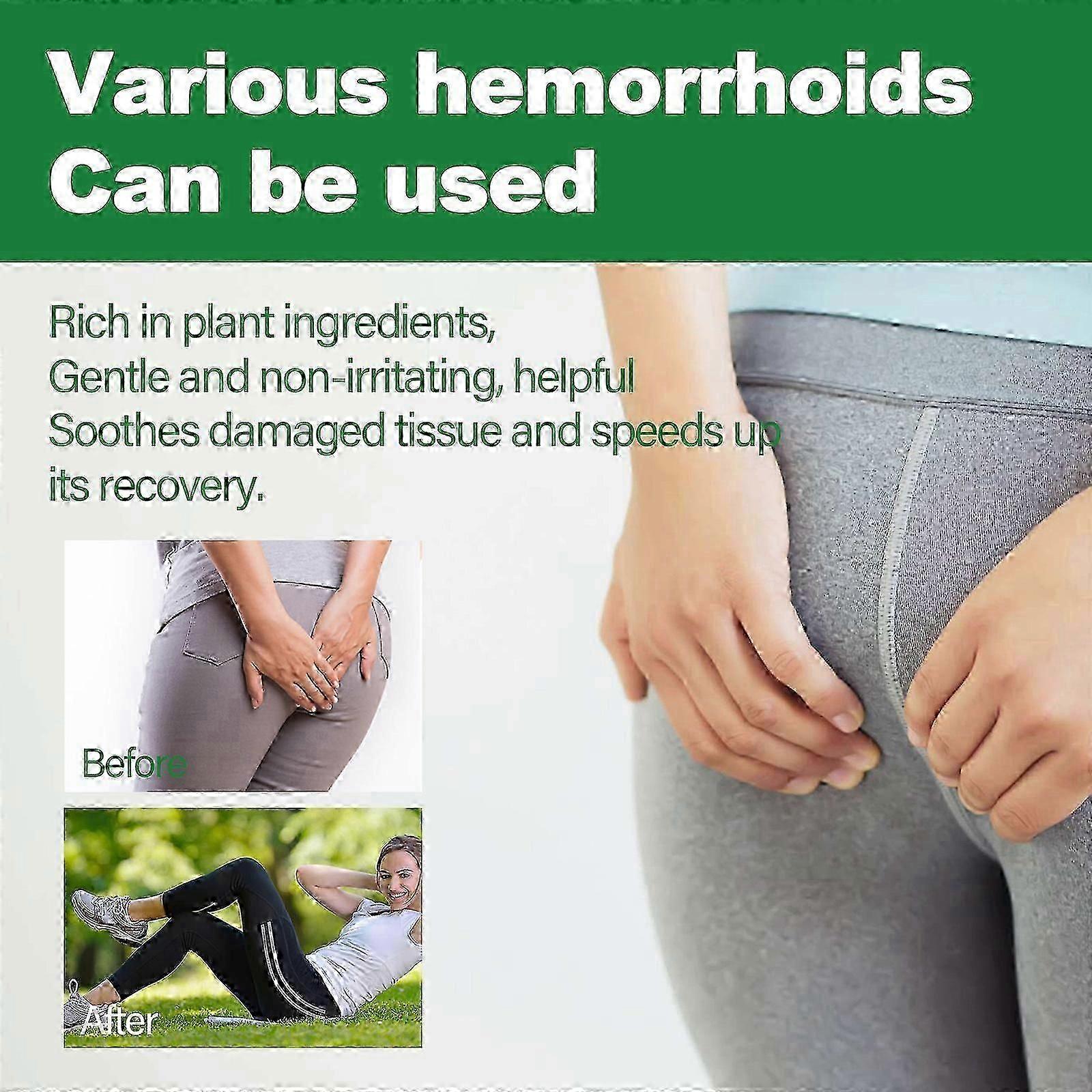 Ximonth Hemorrhoids Spray Relieve Swelling Pain Relieve Itching ...