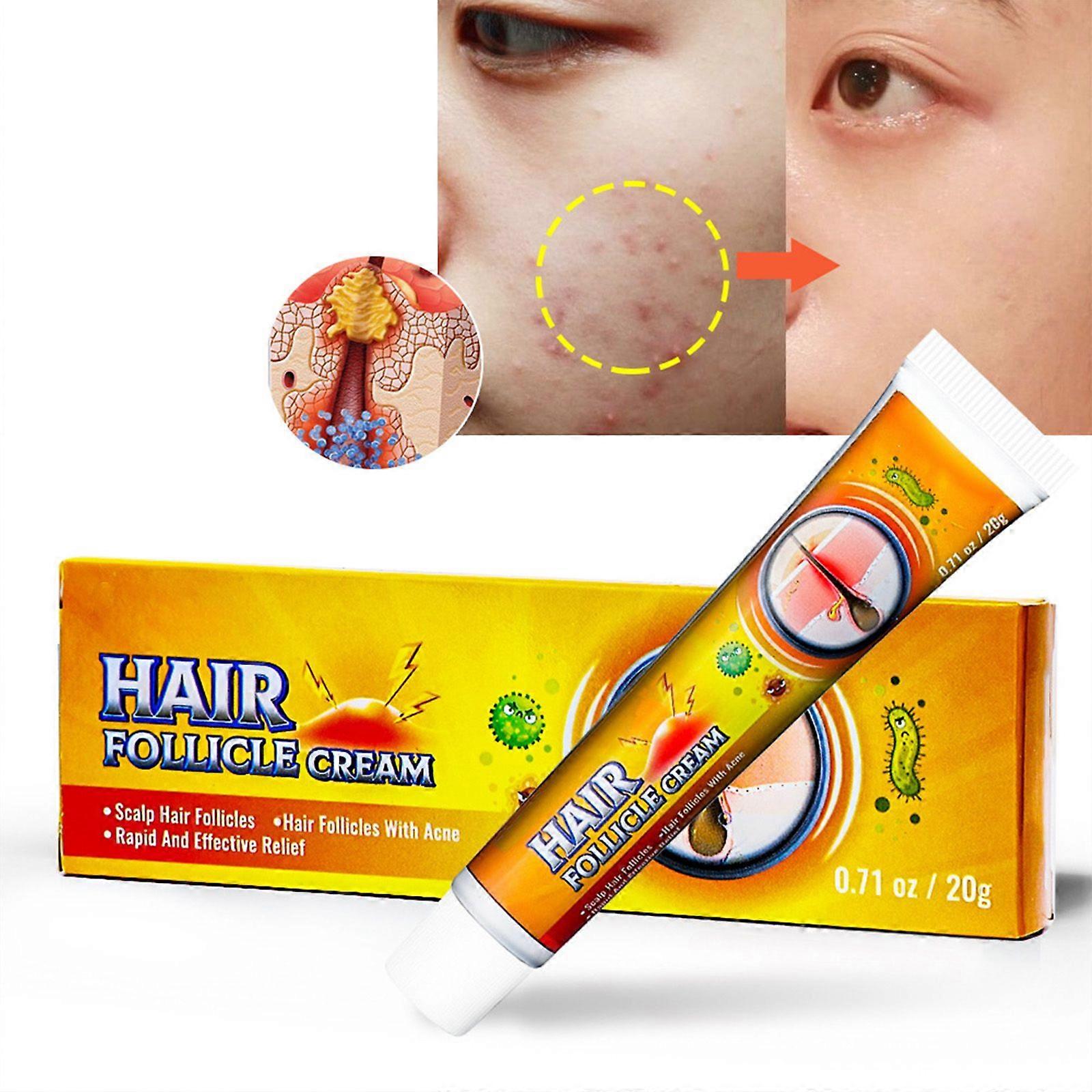 Hair Follicle Repair Cream, Hair Follicle Serum, Hair Follicle Care ...