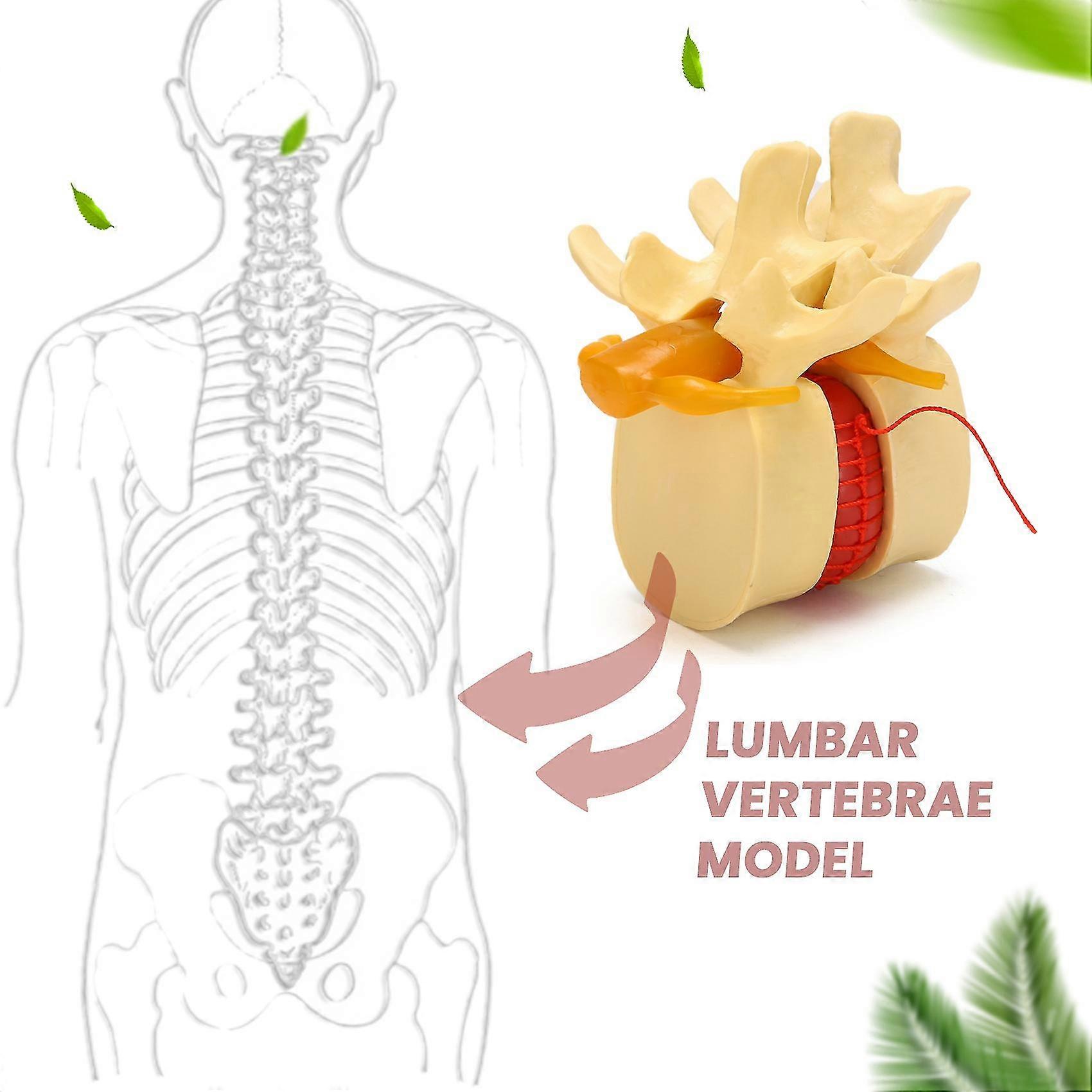 Lumbar Vertebrae Model Anatomical Spine Lumbar Disc Herniation Anatomy ...