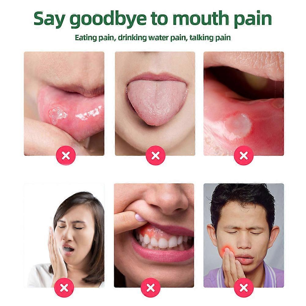 Mouth Ulcer Spray,Mouth Ulcer Treatment Spray for Adluts,Ulcer Breath ...