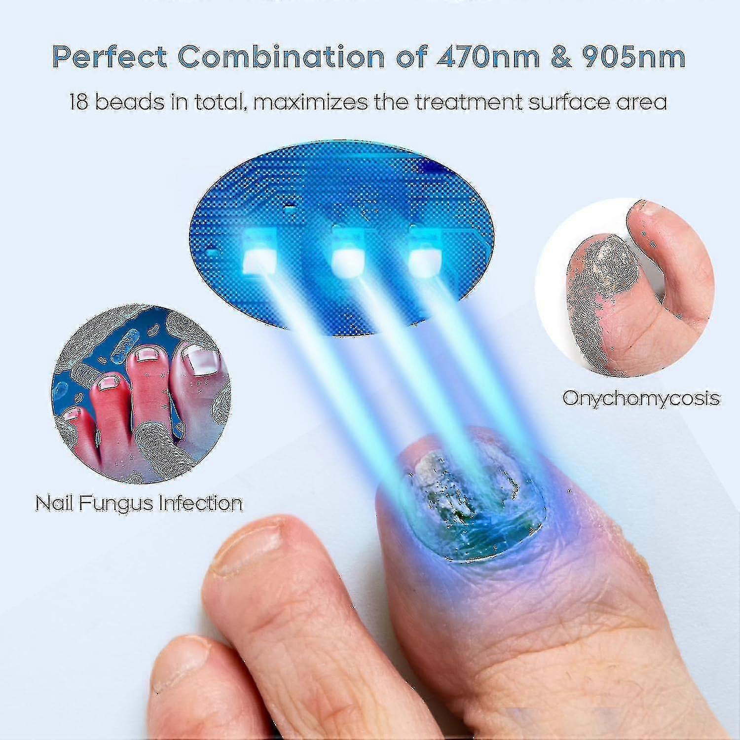 2024 Nail Fungus Laser Treatment Device for Multiple Toenail, Home Use ...