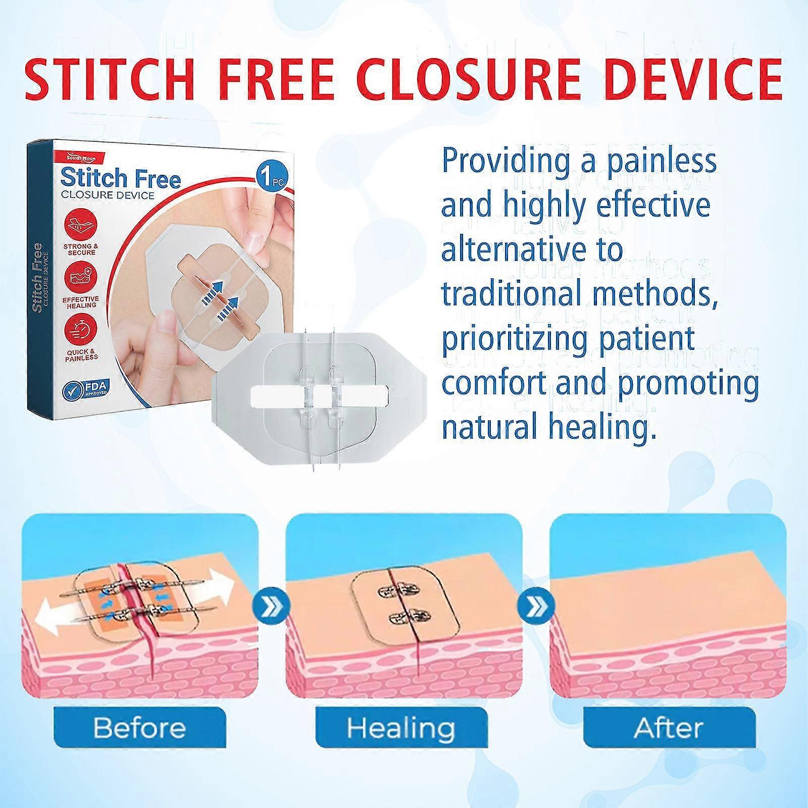 Sutures Butterfly Bandaids, Emergency Wound Closures Device, Surgical ...