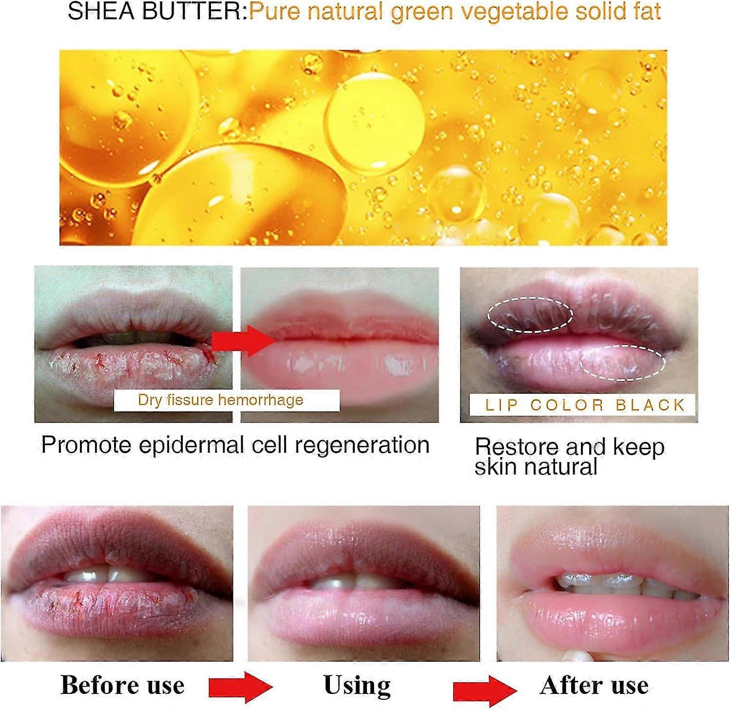 Lip Lightening For Dark Lips,moisturizing Lip Balm Whitening ...
